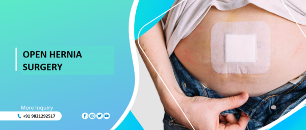 OPEN HERNIA SURGERY – Hernia Surgery Clinic